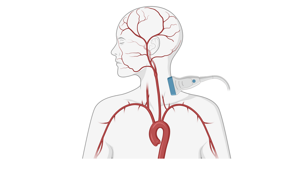 Home Stretch | Blood flow visualized with ultrasound in neck